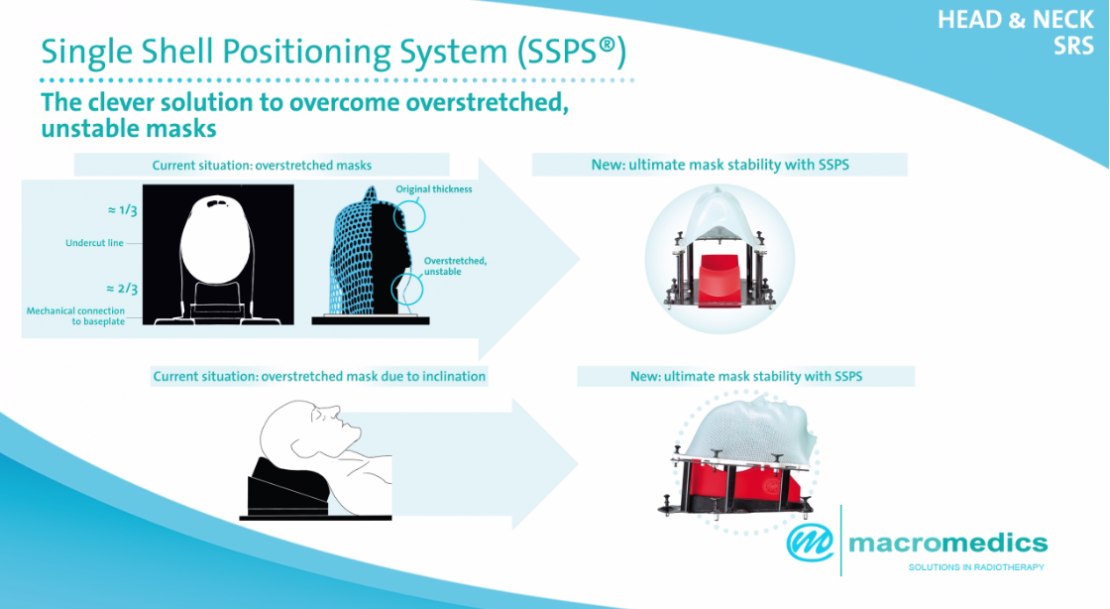 SSPS® - MacroMedics